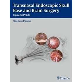 Best pris på Aldo Stamm: Transnasal Endoscopic Skull Base and Brain Surgery: Tips Pearls - Prisjakt