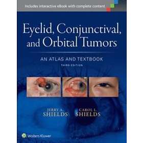 Dr Jerry A Shields, Dr Carol L Shields: Eyelid, Conjunctival, and ...